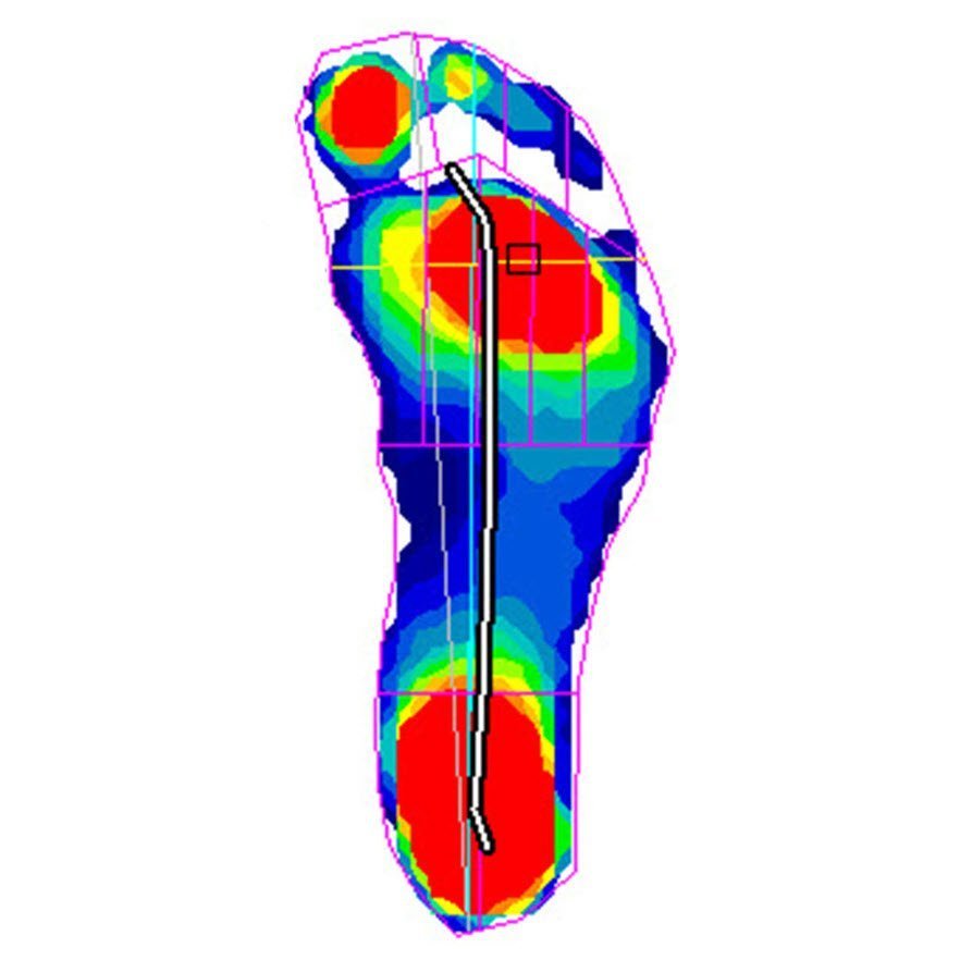 10 Ways To Take Pressure Off A Foot Blister