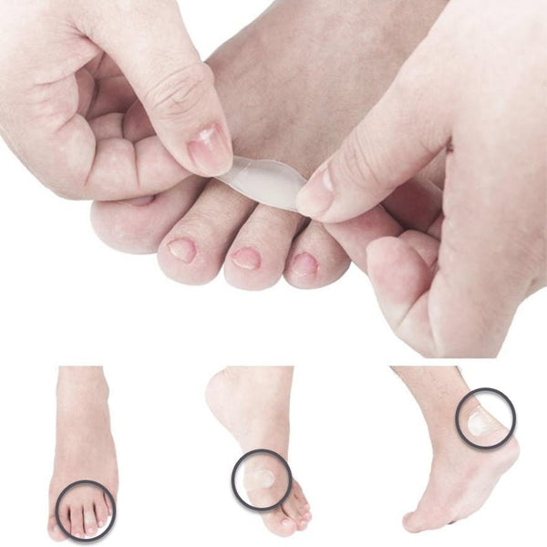 Hydrocolloid Blister Plasters: Your FAQs Answered